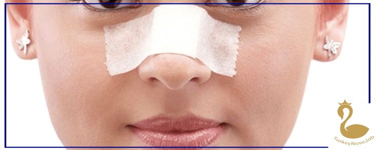 ALL YOU NEED TO KNOW ABOUT NASAL PACKING AFTER RHINOPLASTY ...